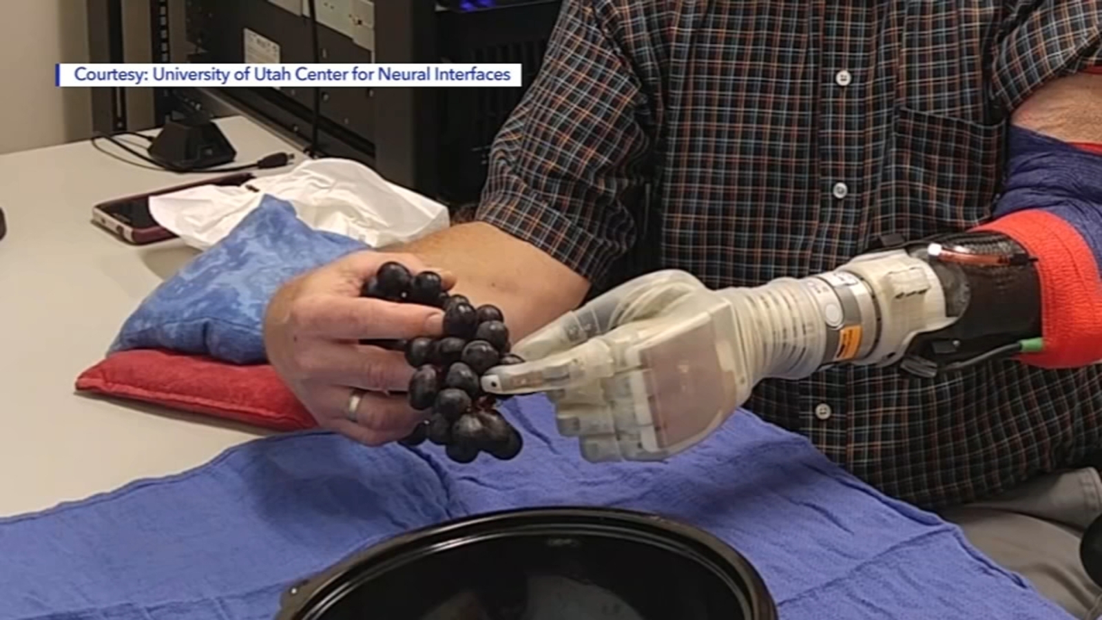 Star Wars-inspired bionic arm helps users control device with their ...