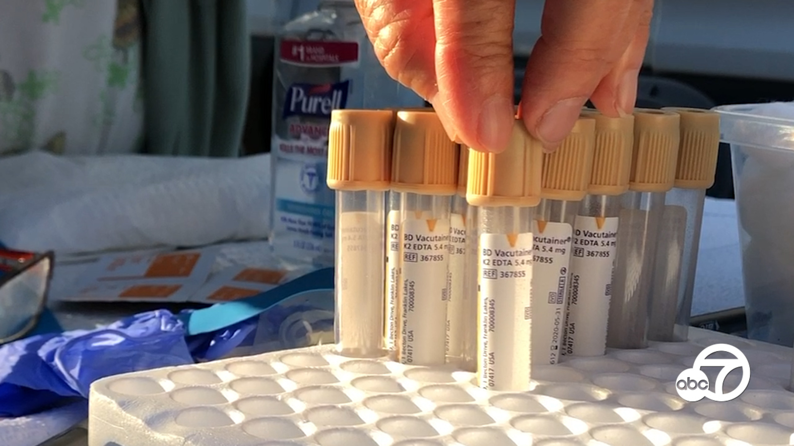 Free blood tests offered to screen for lead poisoning in wake of Exide ...