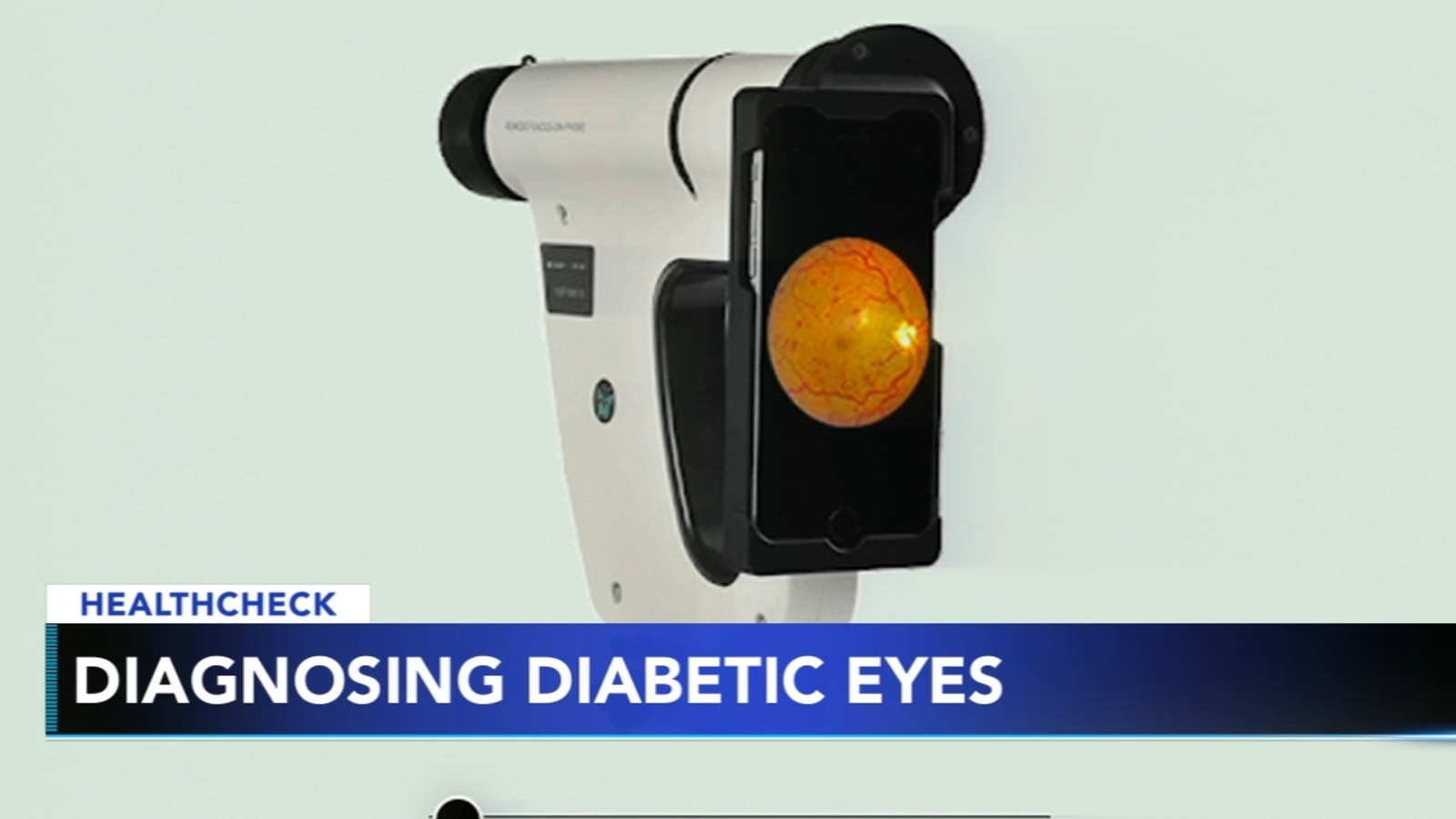 Smartphone-based system accurate picks up diabetic retinopathy - 6abc ...
