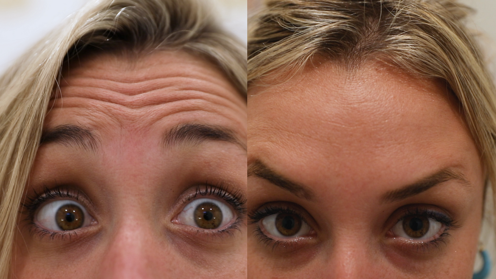 BOTOX BREAKDOWN: Glam Lab breaks down Botox at the new Alchemy 43 in ...