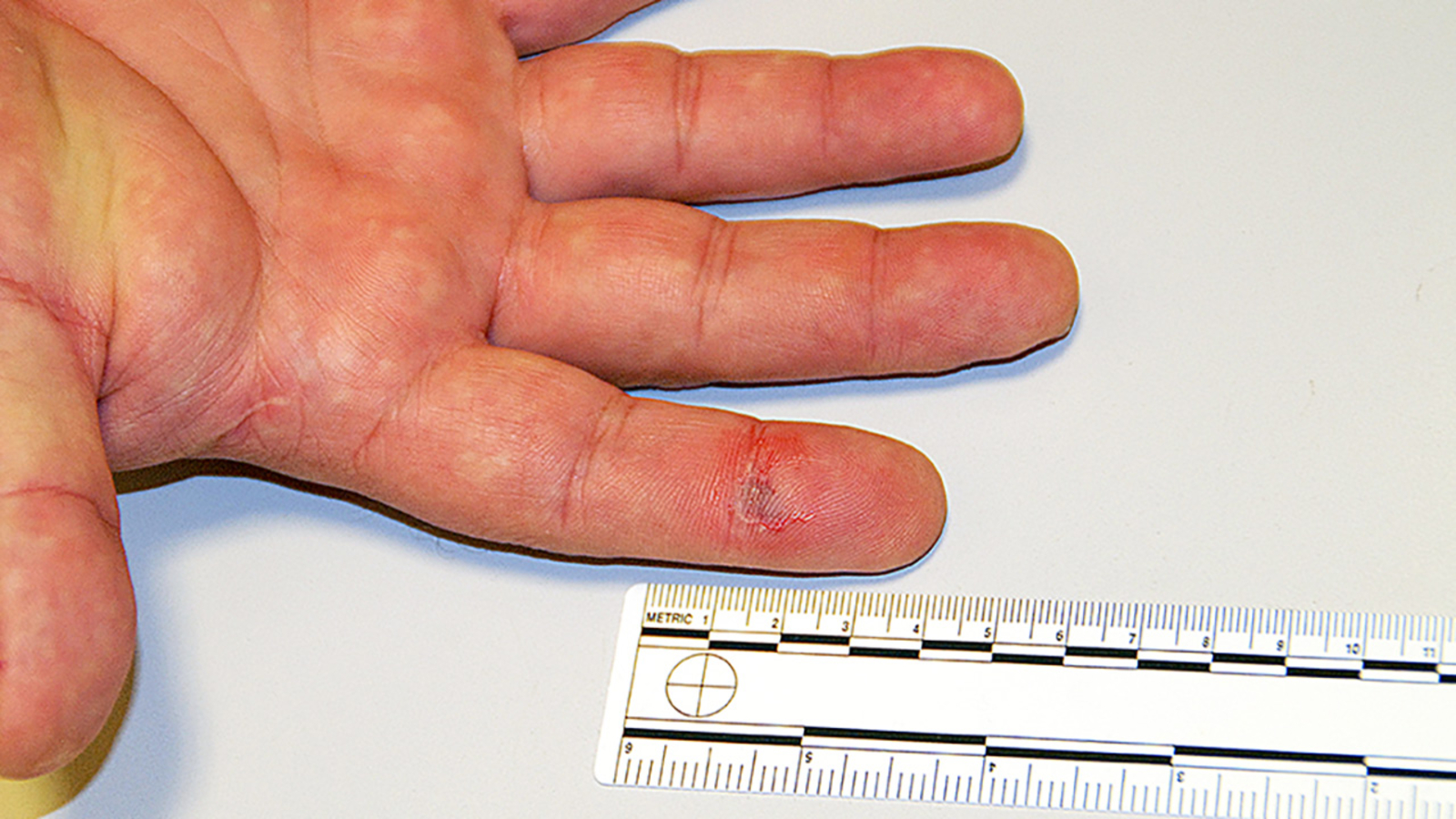 Police: Inmate bites correction sergeant's finger at Yanphank ...