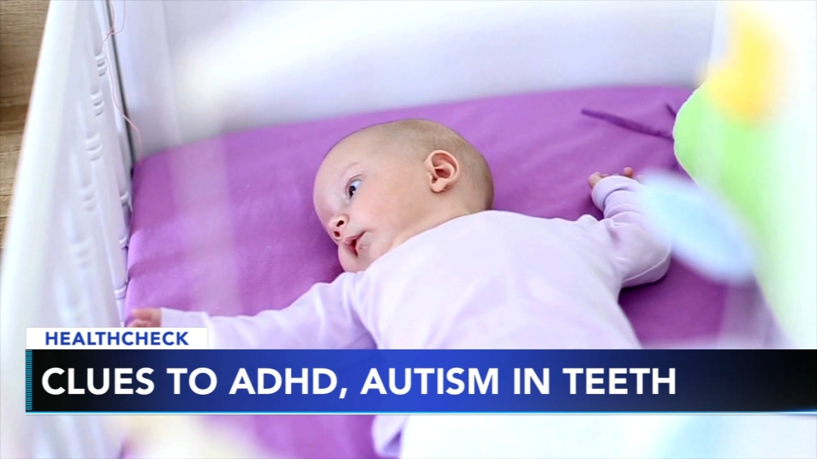 New evidence of baby teeth link to ADHD, autism - 6abc Philadelphia