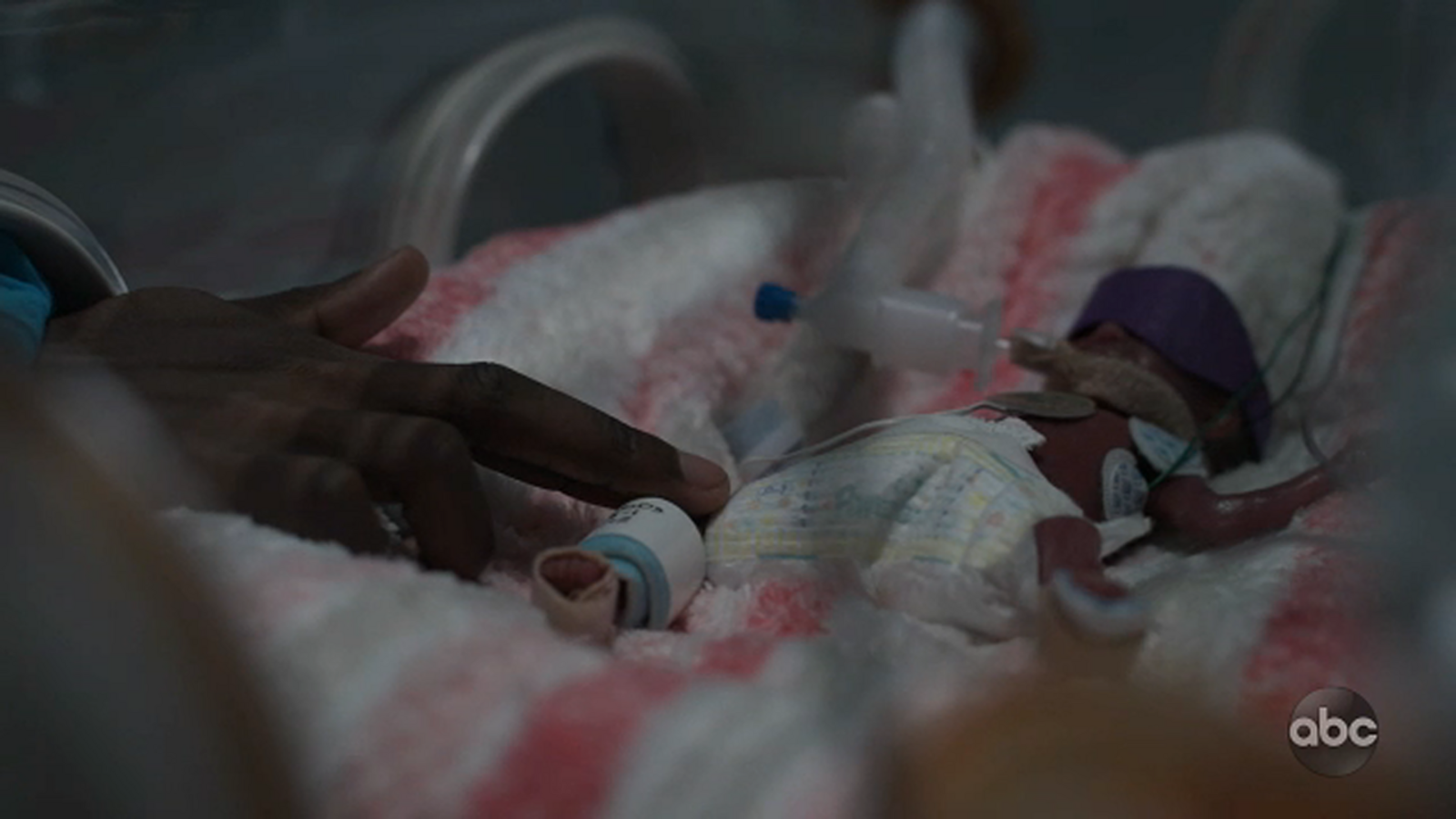 'The Good Doctor' in real life: Surviving premature births - ABC7 New York