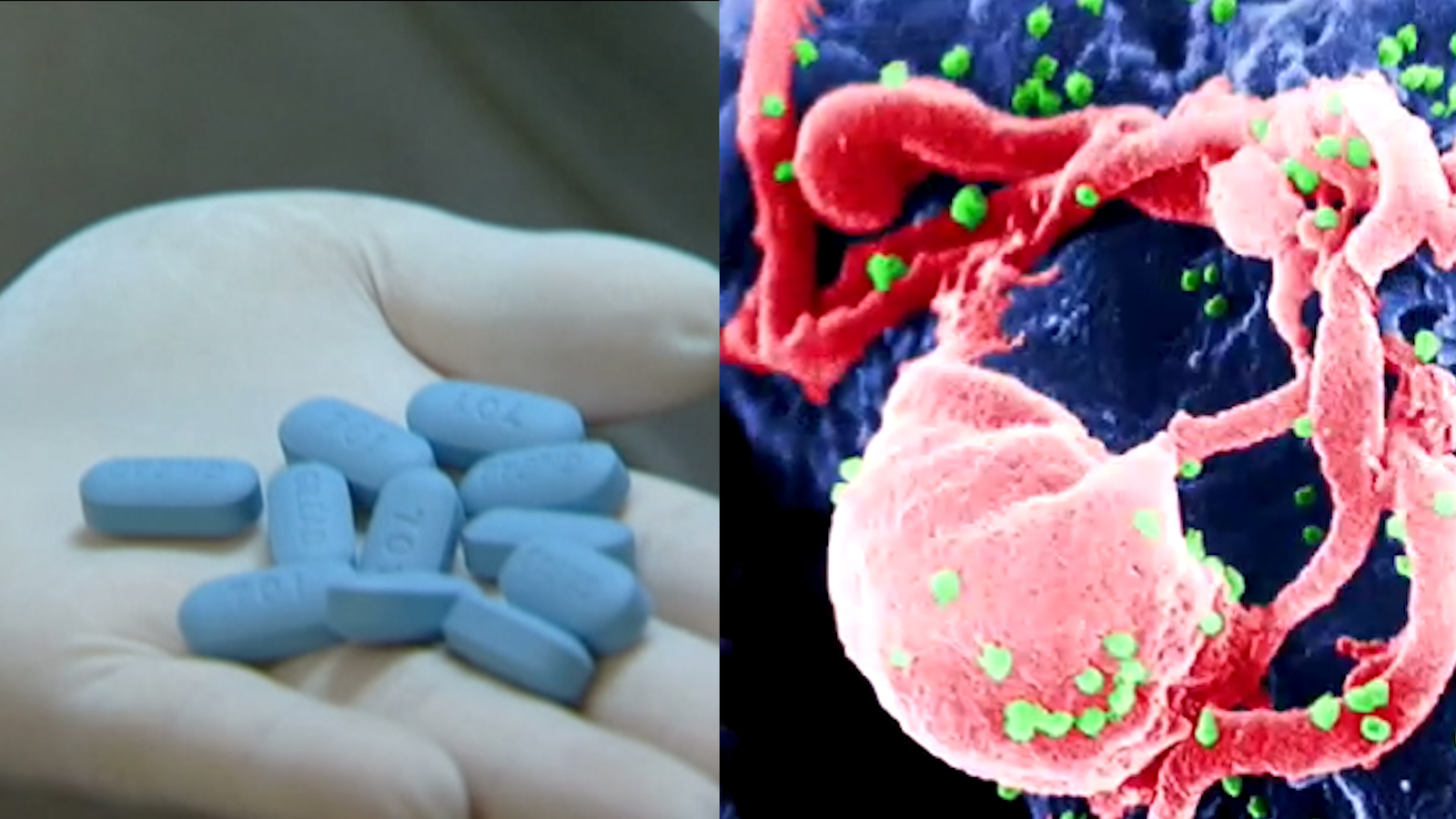 Ready, Set, PrEP: The battle to end the HIV/AIDS epidemic in New Jersey ...