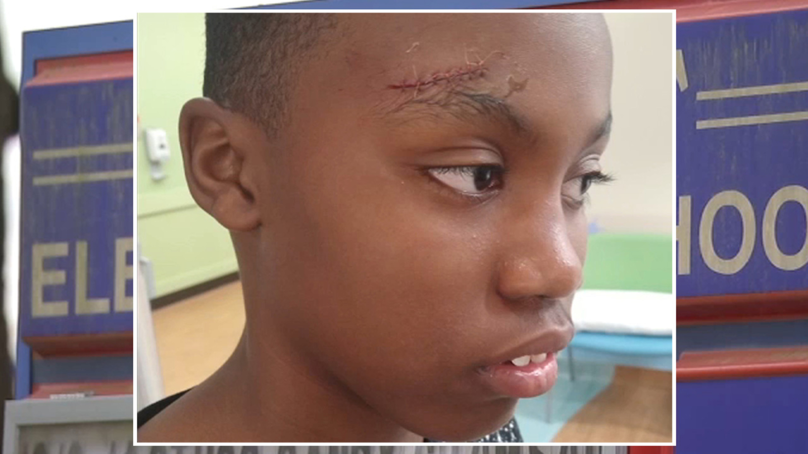 Cy-Fair ISD mother says 5th grader got gash in head during altercation ...