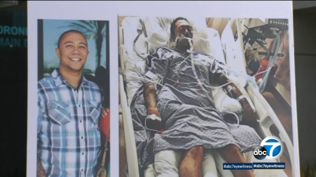 Christopher Eisinger: Jury finds Anaheim officers negligent, largely ...