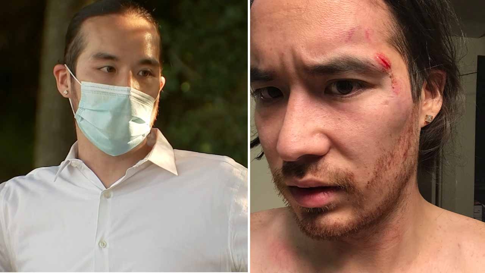 Cameraman injured after being hit by demonstrators during protests in ...