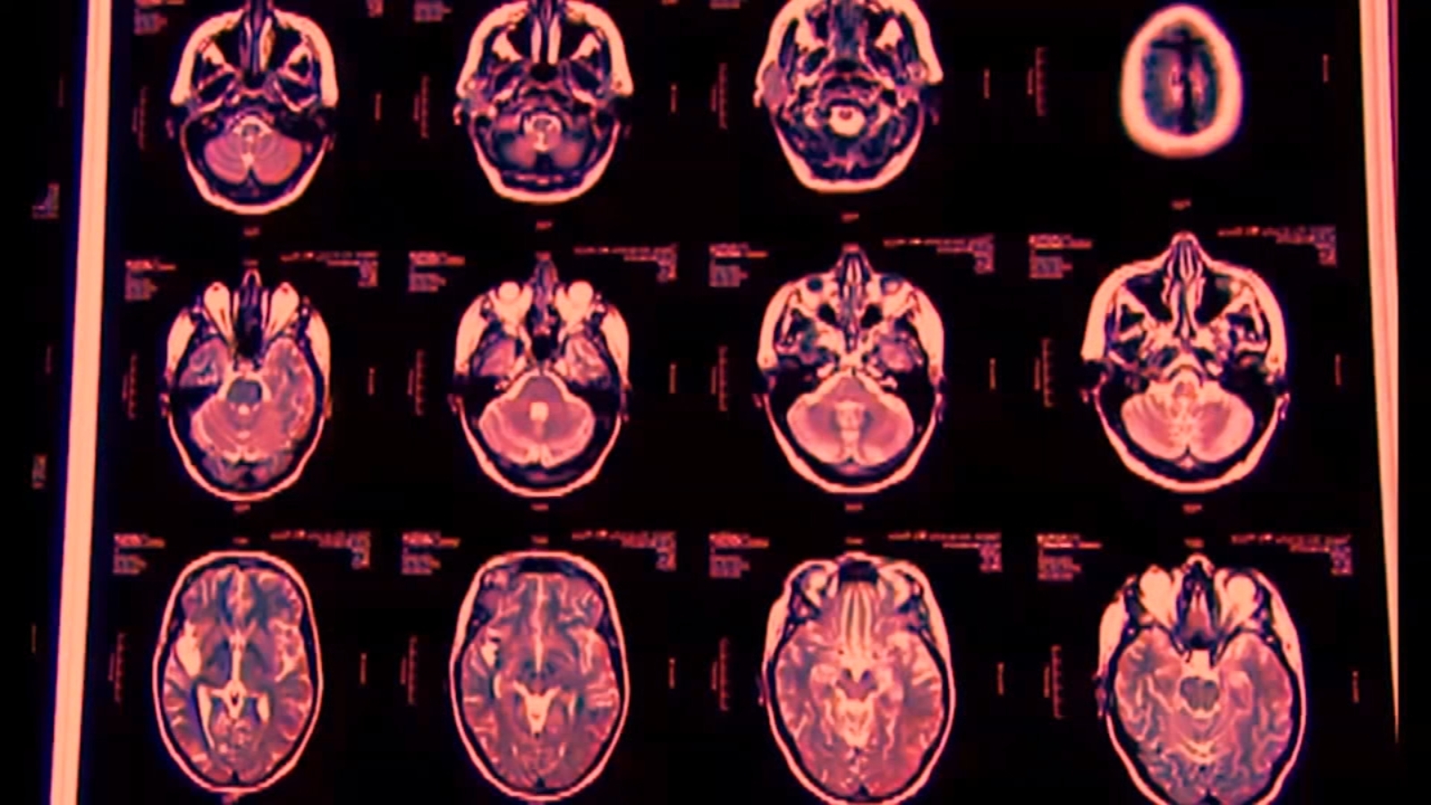 uMETHOD: Raleigh company develops program to help prevent Alzheimer's ...