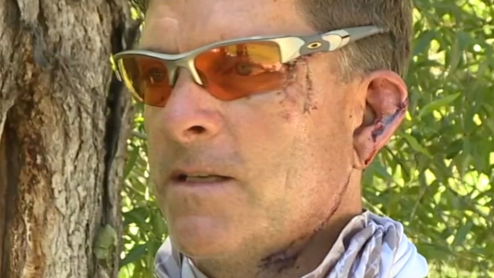 'Like a brick hit me in the head': Man speaks after bear attack inside ...
