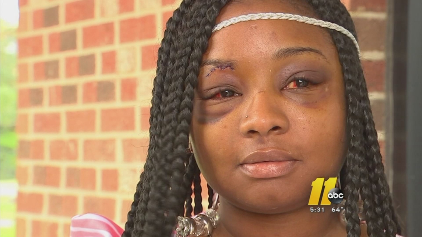 Woman Survives Car Ride Beating From Chapel Hill To Durham Abc11