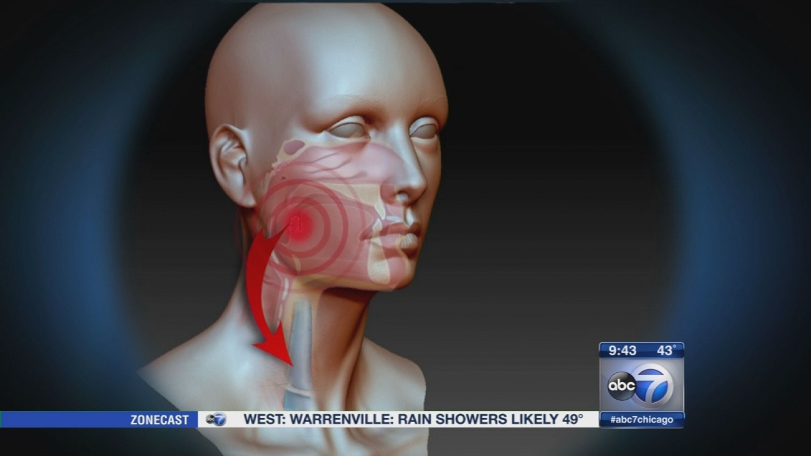 Is It Strep Or Something More Dangerous ABC7 Chicago is-it-strep-or-something-more-dangerous-abc7-chicago