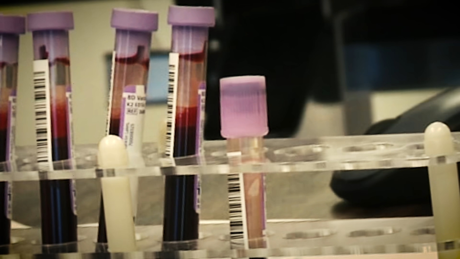 Can your blood type affect your risk for COVID-19 complications? - 6abc ...