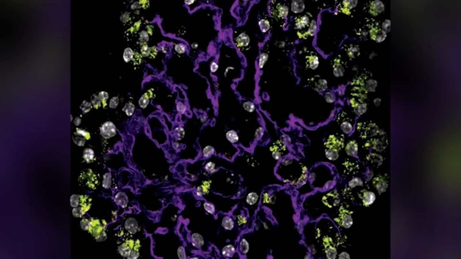 Duke, UNC scientists team up to create lab-grown mini-lungs that ...