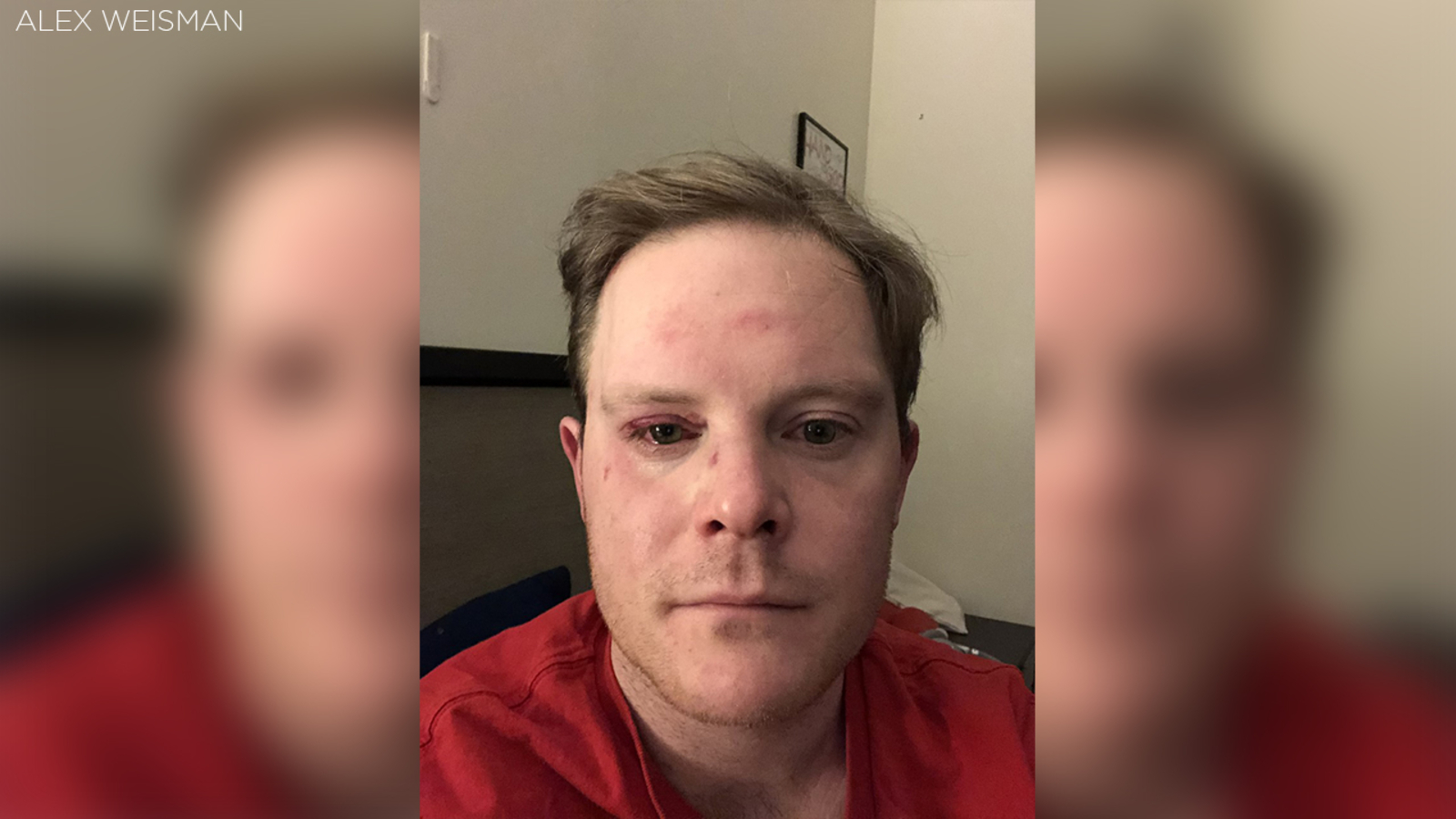 Broadway actor known for role on "Harry Potter and the Cursed Child ...